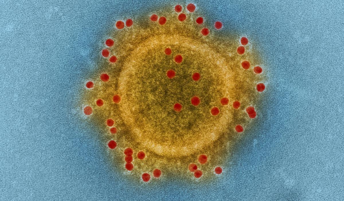 EXPLAINER: Everything you need to know about the new Omicron XE ...