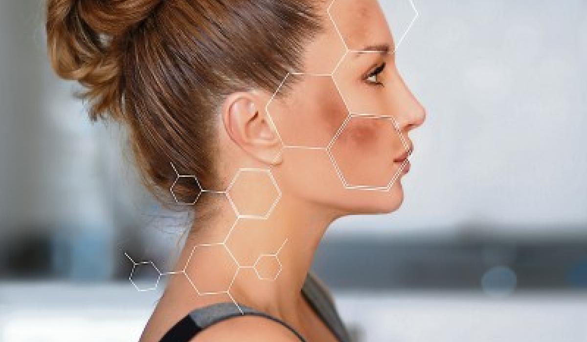 The Beauty Spot: How to tackle tricky dark patches on your skin ...